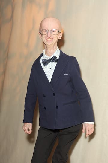 E' morto Sammy Basso, il 28enne malato di progeria: chi era | Sky TG24