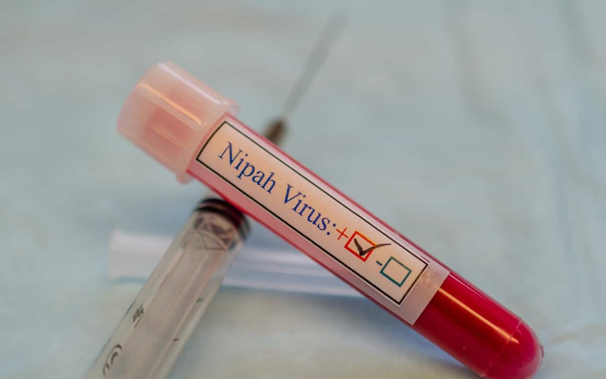 Virus Nipah, test su 60 volontari del primo vaccino | Sky TG24