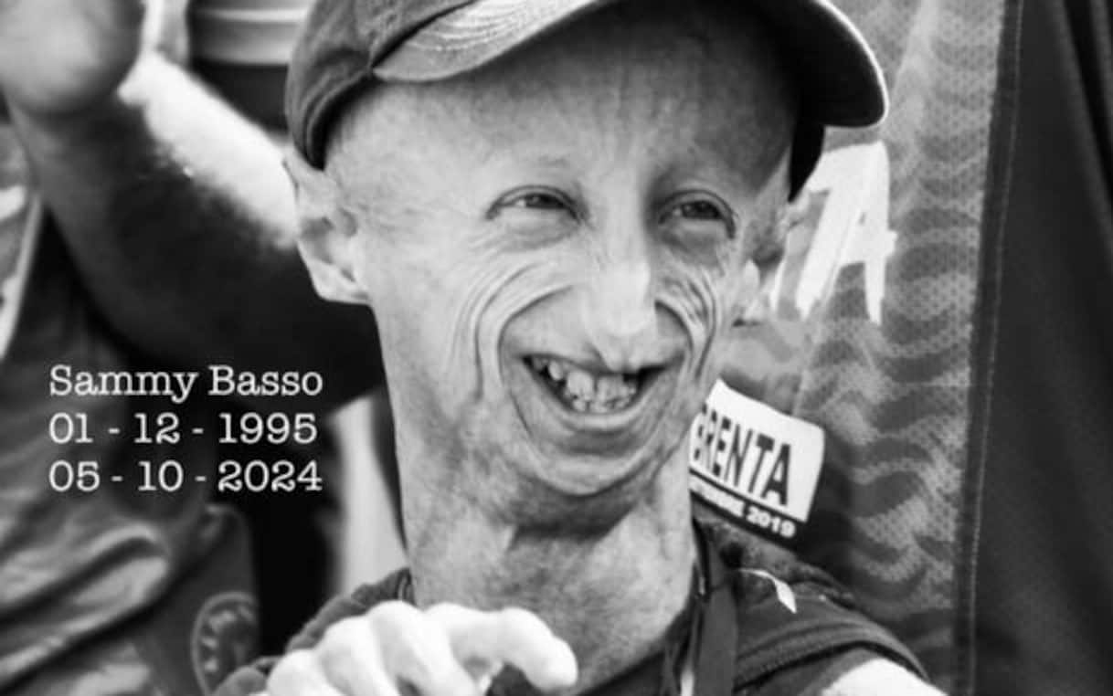 E' morto Sammy Basso, il 28enne malato di progeria: chi era | Sky TG24