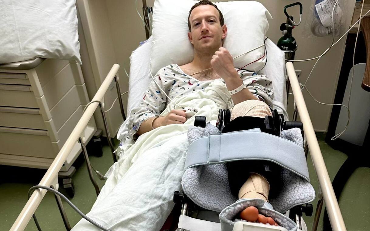 Mark Zuckerberg ricoverato in ospedale, si è rotto un legamento durante ...